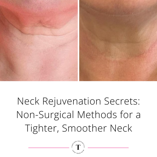 Neck Rejuvenation Secrets: Non-Surgical Methods for a Tighter, Smoothe ...